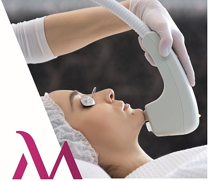 Depilacja Laserowa? The Epi Lab jest najlepszy na świecie! - Maeve